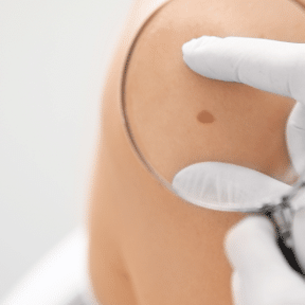 Columbia Skin Clinic - South Carolina's Most Experienced Dermatologists