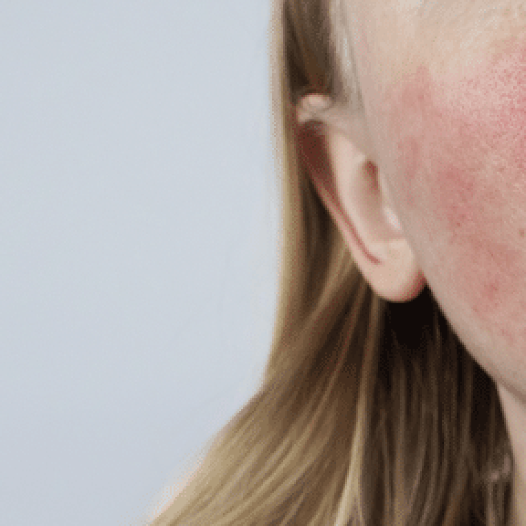 Columbia Skin Clinic - South Carolina's Most Experienced Dermatologists