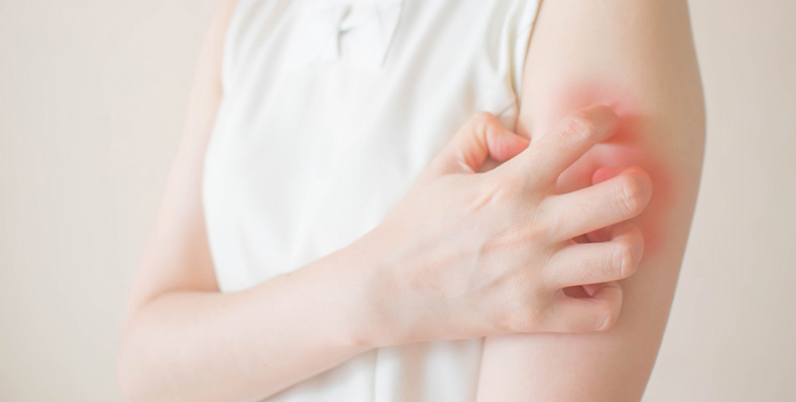 A Guide to Skin Infections - Columbia Skin Clinic