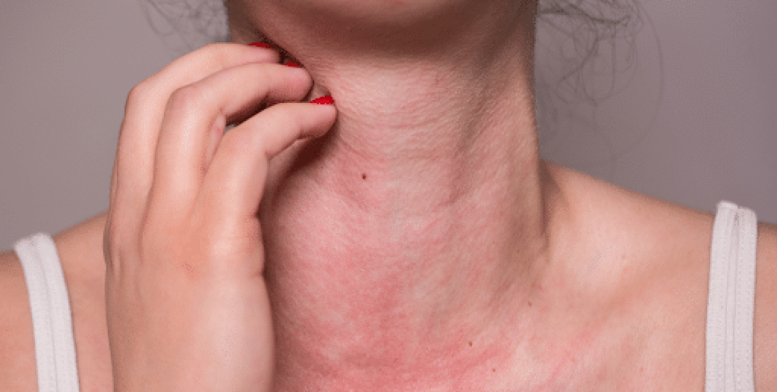 Spring Skin Allergies: How to Prevent and Treat Irritations - Columbia ...