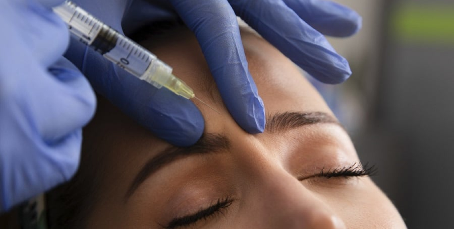 How Much Botox Do I Need? | Columbia Skin Clinic